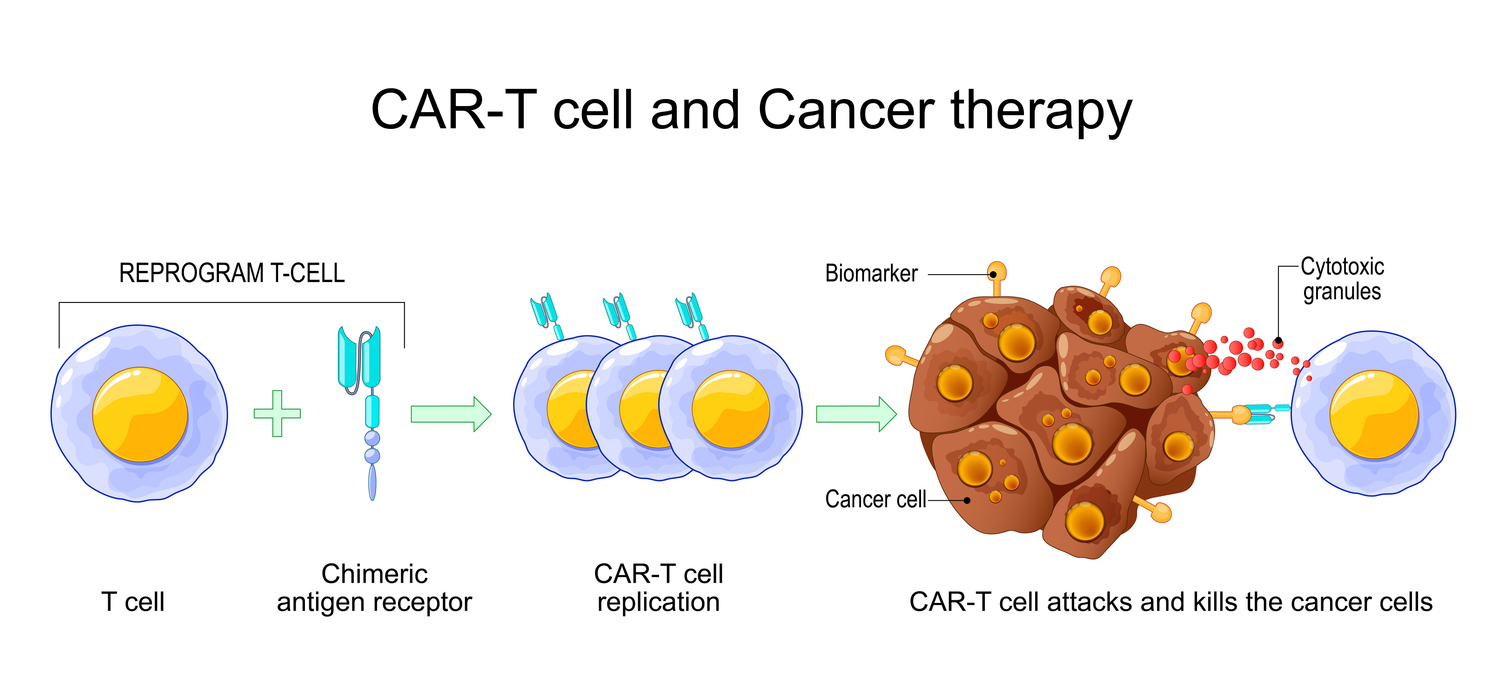 CAR-T and CAR-NK Cell Therapies: Transforming Cancer Treatment | PBL Assay Science